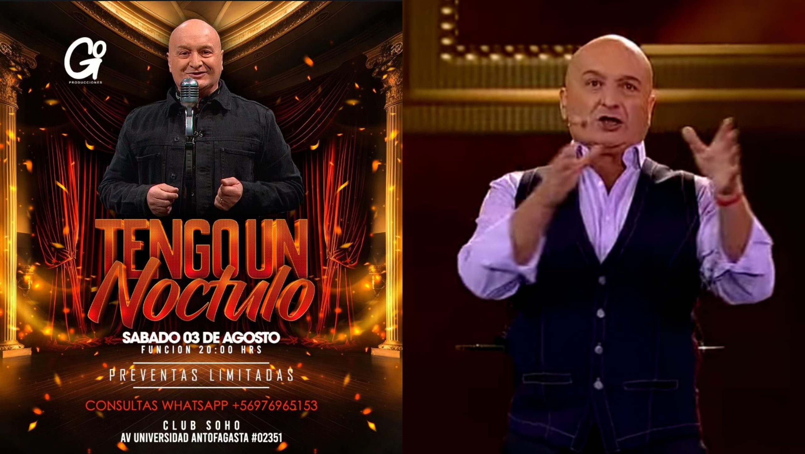 “Tengo un nóctulo”: Así se llama el show que realizará Ricardo Meruane ...